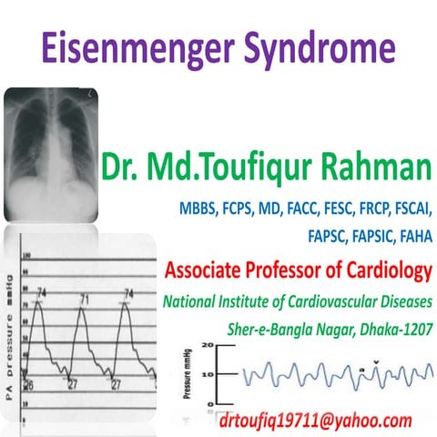 Eisenmenger Syndrome Dr md toufiqur rahman cardiologist nicvd | PPTX