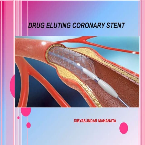 Drug eluting stent | PPT