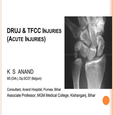 Druj and tfcc injuries f | PPTX