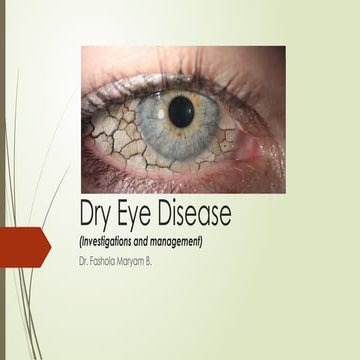 Investigations and Management of Dry Eye.pptx