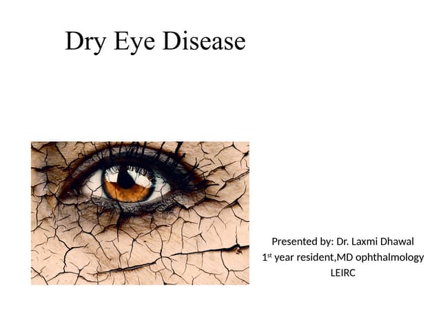 Dry eye: An Overview | PPTX