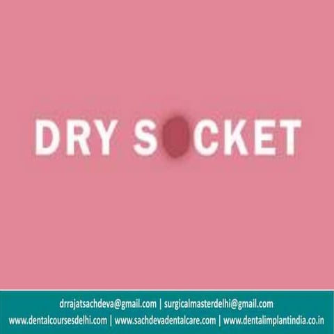 Dry socket | PPTX