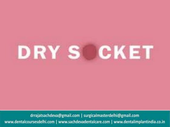 Dry socket, alveolar ostitis | PPT