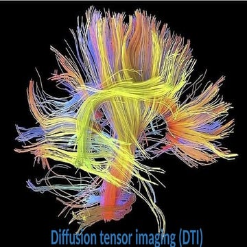 DTI imaging magnetic resonance imaging.pptx