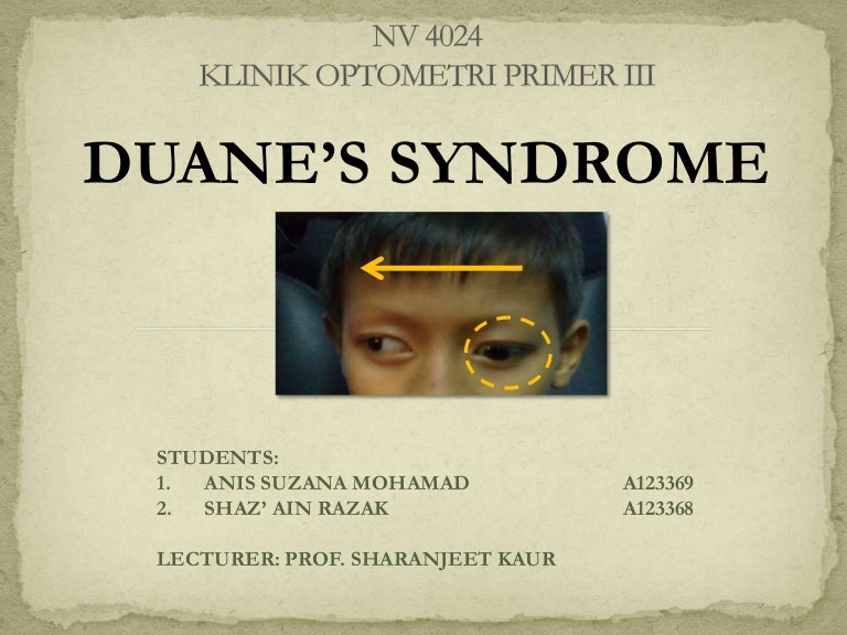 Case Presentation: Duane's Syndrome
