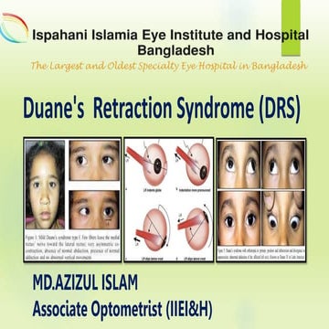 Duane's Retraction Syndrome Guide | PPT