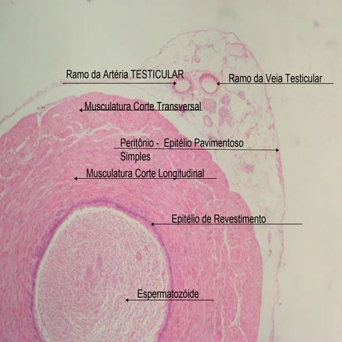 Ducto Deferente | PPT