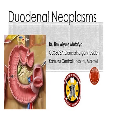 Duodenal neoplasms.pdf