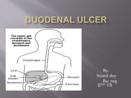 Peptic ulcer disease (pud) | PPT