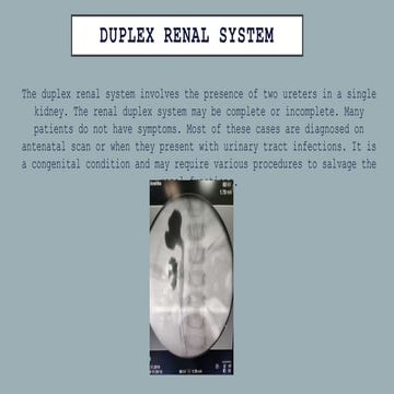 Best Duplex Renal System Treatment in Delhi | PPTX