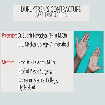 Dupuytren's contracture Plastiquest | PPTX