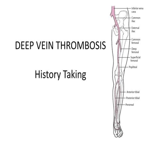 Homan’s Sign for DVT.pptx