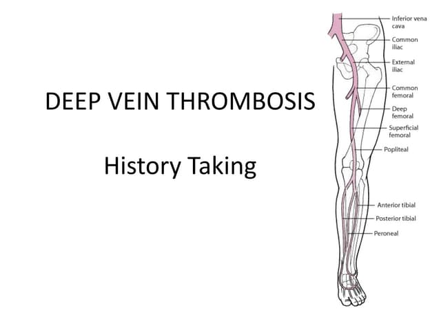 Homan’s Sign for DVT.pptx