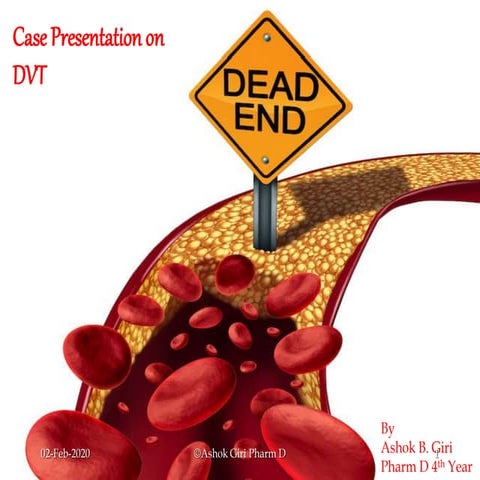 Deep Vein Thrombosis | PPT