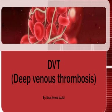 DVT | PPTX