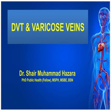 DVT and Vericose Vein and it causes and treatment | PPTX