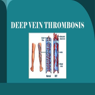 DVT assessment (1).pptx all about DVT assessment | PPTX
