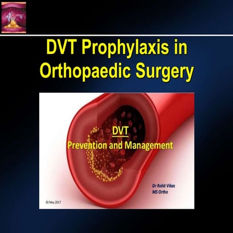 DVT_34455432422467655446532345677654334.ppt