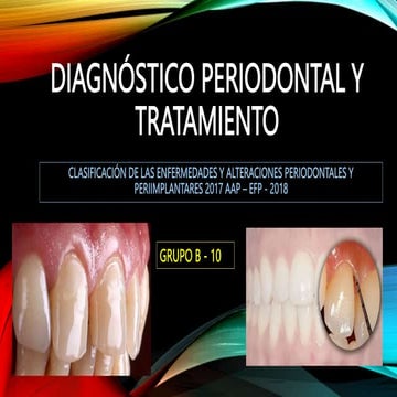 dx periodontal.pptx