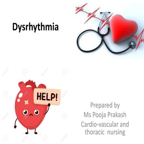 DYsrhythmia.pptx
