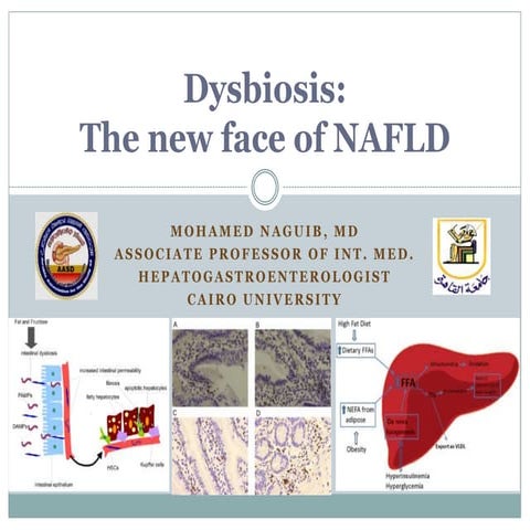 Dysbiosis and NAFLD.pptx | Digestive Disorders | Diseases and Conditions