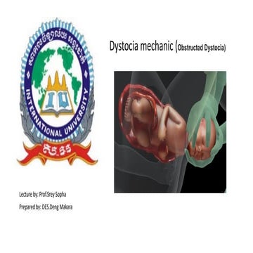 Dystocia mechanic (Obstructed Dystocia).pdf