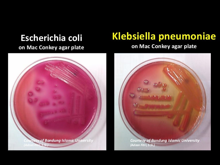 Escherichia coli & Klebsiella pneumoniae (UNISBA - Indonesia)