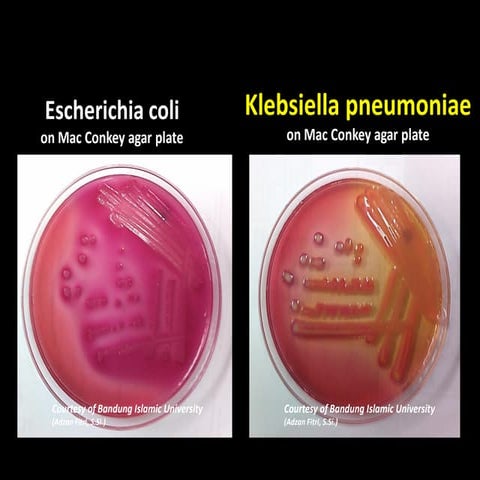 Escherichia coli & Klebsiella pneumoniae (UNISBA - Indonesia) | PPT