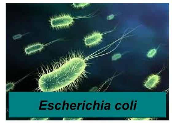 E. coli | PPTX | Digestive Disorders | Diseases and Conditions