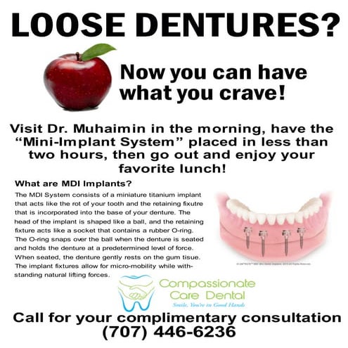 mini implant flyer COLOR v1.0 | PDF