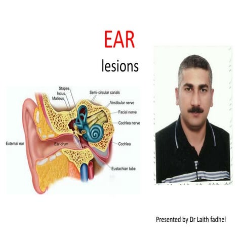 Ear | PPTX