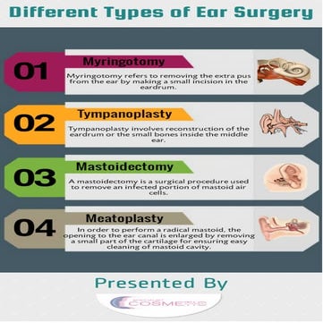 Different types of Ear Surgery | PDF