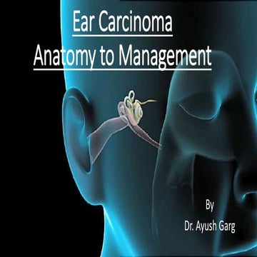 Ear carcinoma | PPTX