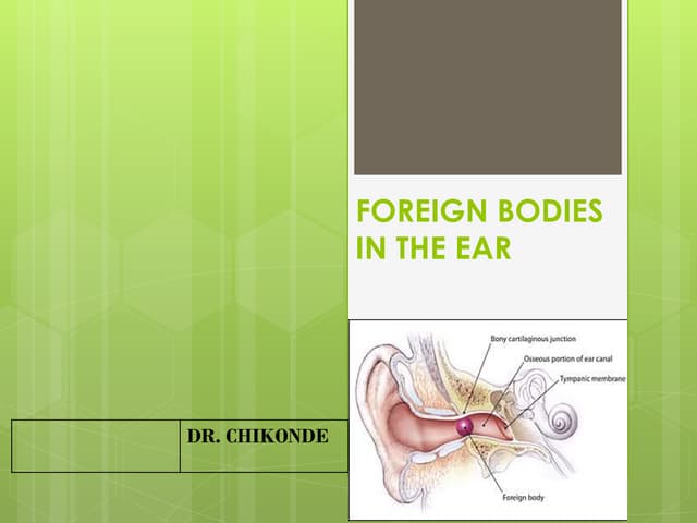 Foreign bodies in the ear | PPTX