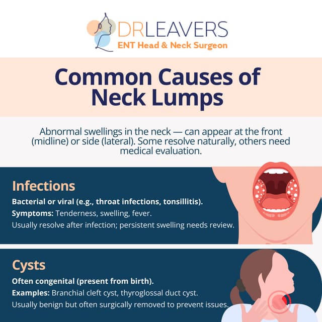 Understanding Grommets by Dr Brett Leavers - ENT Surgeon | PDF
