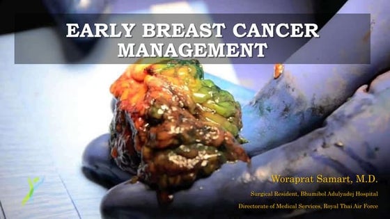 Sentinel node and PET for local advanced breast cancer | PPT