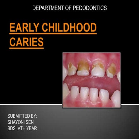 Early childhood caries | PPTX