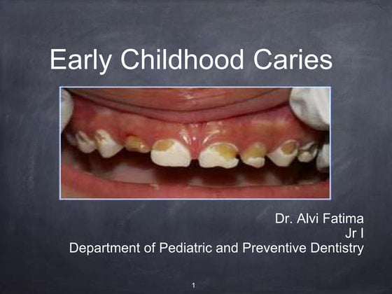 Early childhood caries | PPTX