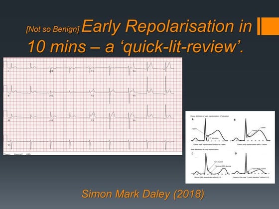 Early Repolarization In Children Early Repolarization Syndrome: A