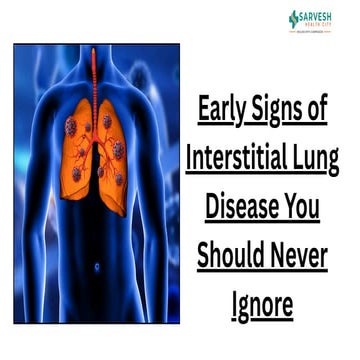 Early Signs of Interstitial Lung Disease You Should Never Ignore.pdf