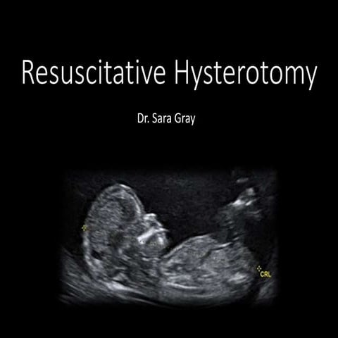 Resuscitative Hysterotomy: Sara Gray | PPTX