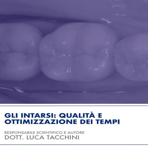 Gli intarsi: qualità e ottimizzazione dei tempi | PDF