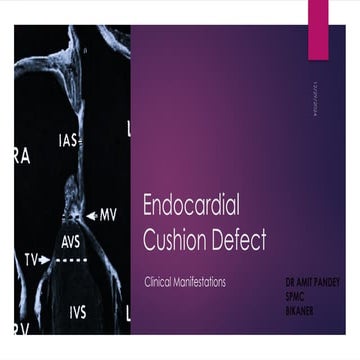 ecd-in congenital heart diseases PANDEY.pptx