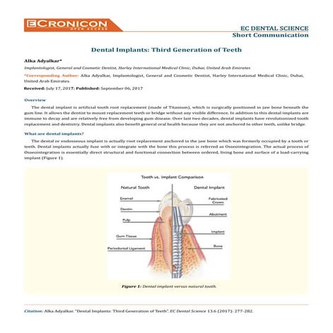 Implant Evaluation.pptx
