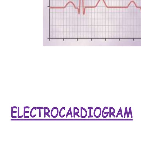 Electrocardiogram | PPT | Free Download