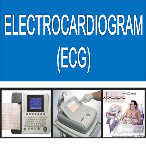 Basics of ECG | PPT