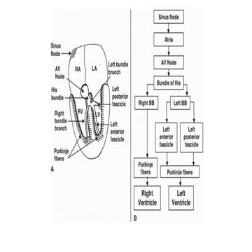Localization of WPW( accessory Pathway) by surface ECG | PPTX