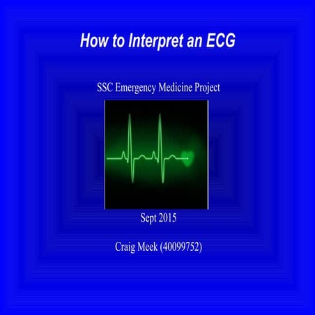 Ecg Analysis Ppt Interpretation Of Electrocardiogram Ppt
