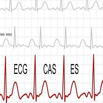 ECG-cases.pptx
