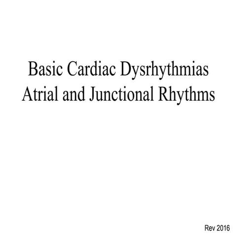 Ecg dysrhythmias-ii | PPT